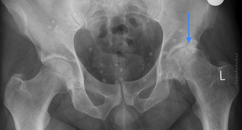 Röntgen - Orthopadie Würzburg Kitzingen